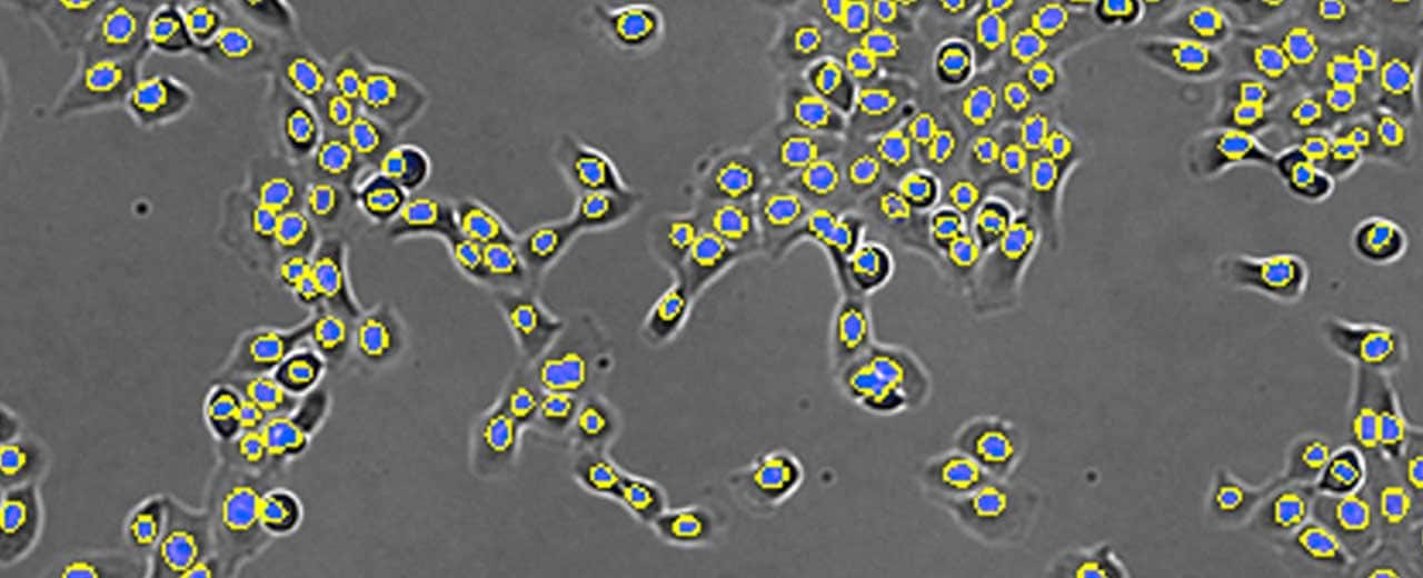 Cell Counting - TekTalk Newsletter