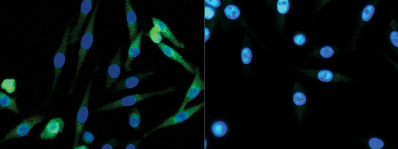 Automated Nuclear Translocation Assays