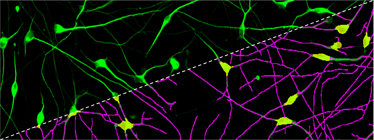 Neurite Outgrowth TekTalk