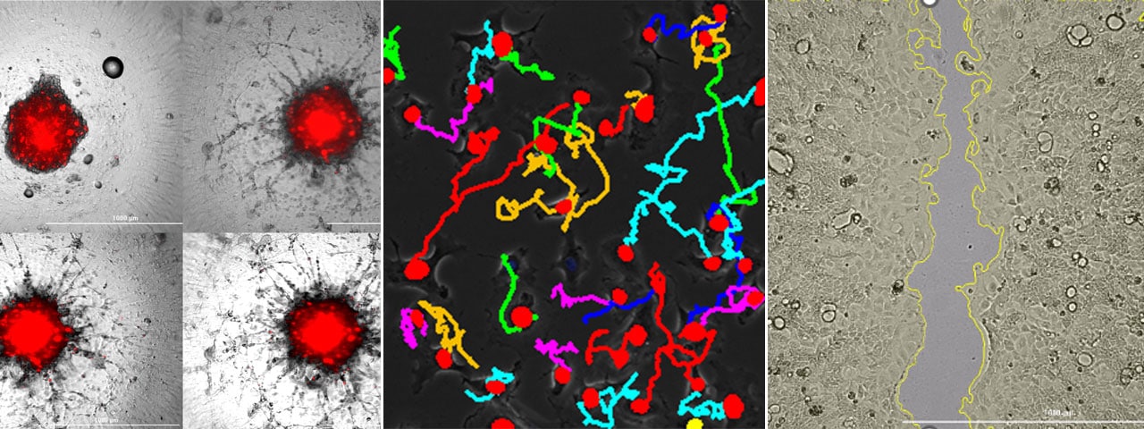 In Vitro Cell Migration Assays