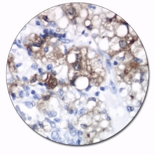 Renal Cell Carcinoma Marker Antibody (Autostainer Link 48) | Agilent