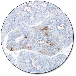 PD-L1 IHC 28-8 pharmDx for Autostainer Link 48 | Agilent