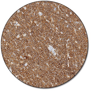 IgM, Specific for Mu-Chains Antibody (Dako Omnis) | Agilent