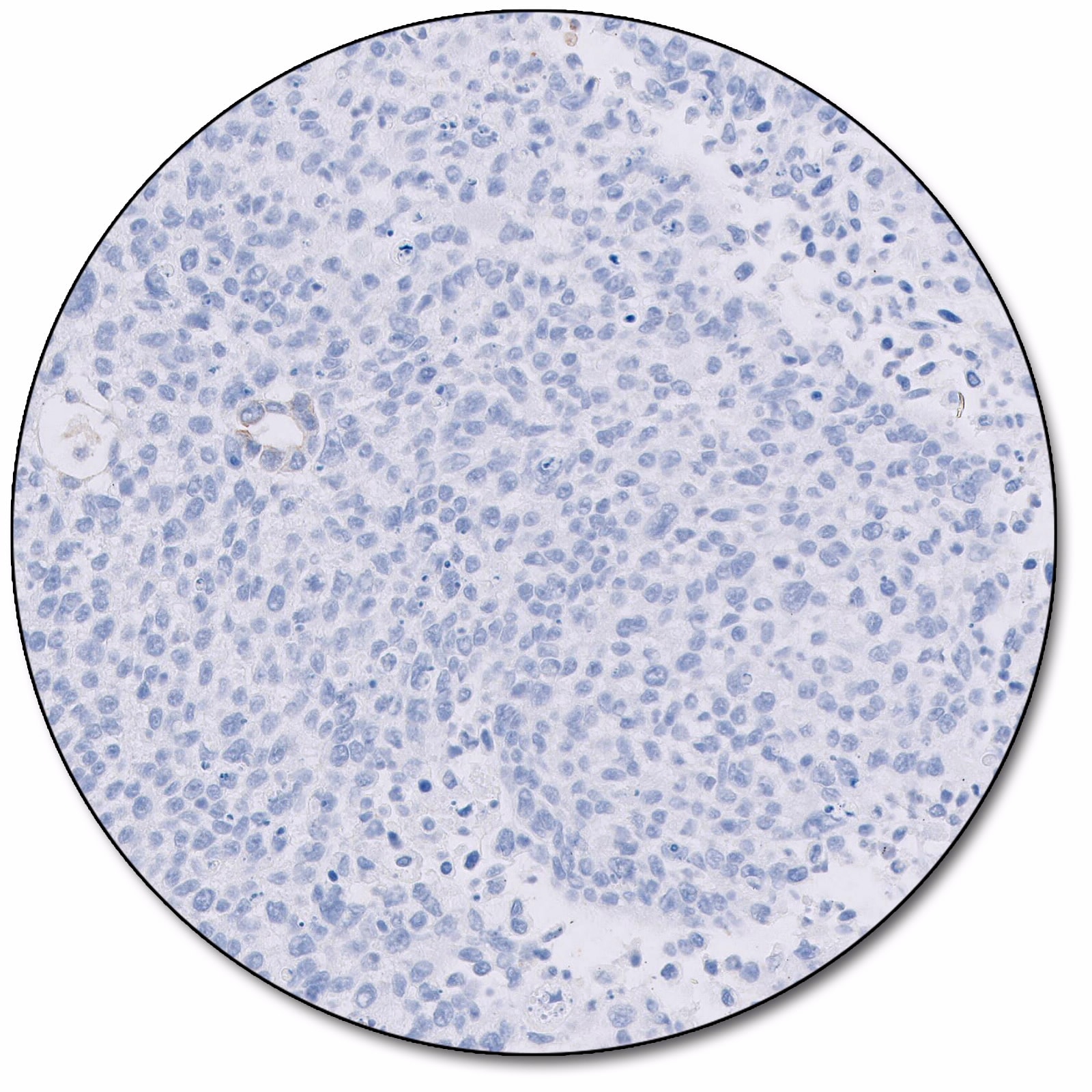 PD-L1 IHC 22C3 pharmDx for use with Dako Omnis | Agilent