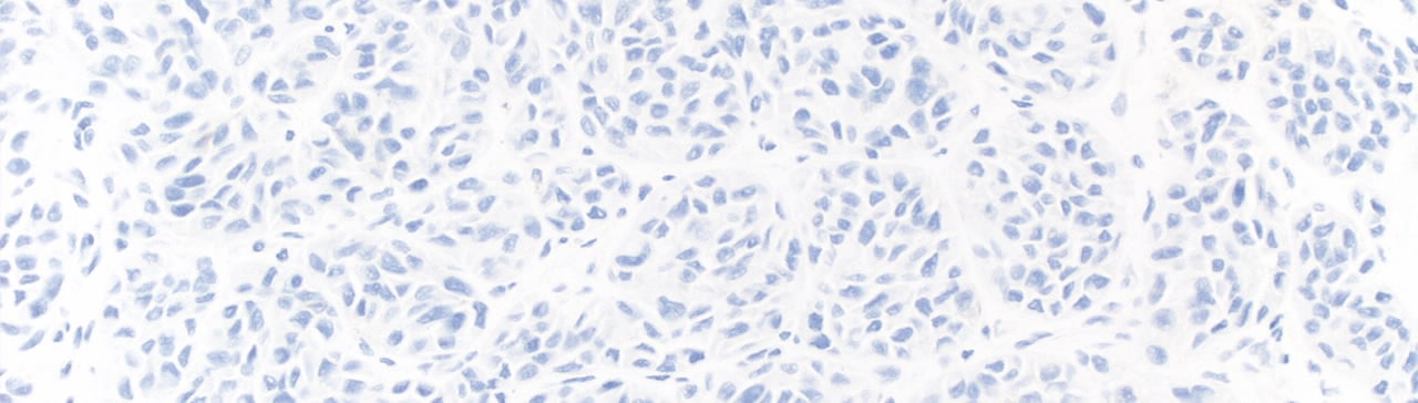 Negative Controls for Autostainer Link 48 | Agilent