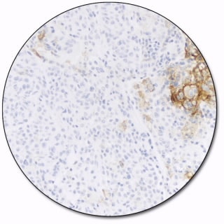 PD-L1 IHC 28-8 pharmDx for Autostainer Link 48 | Agilent