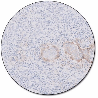 PD-L1 IHC 22C3 pharmDx for Autostainer Link 48 | Agilent