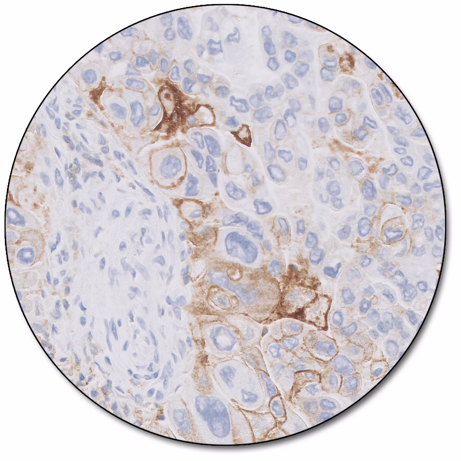 PD-L1 IHC 22C3 pharmDx for Autostainer Link 48 | Agilent