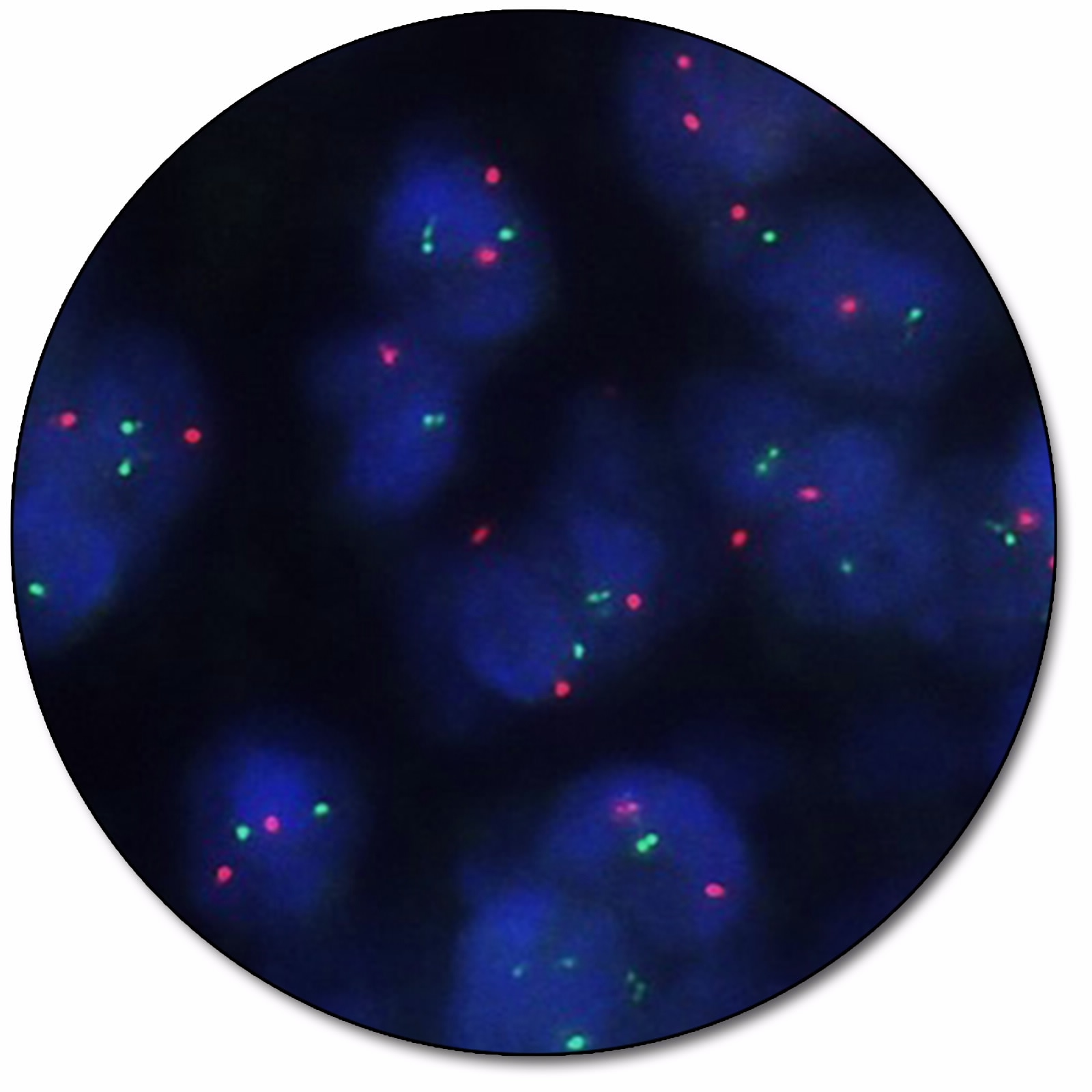 IGH/BCL2 IQFISH Dual Fusion Probe | Agilent