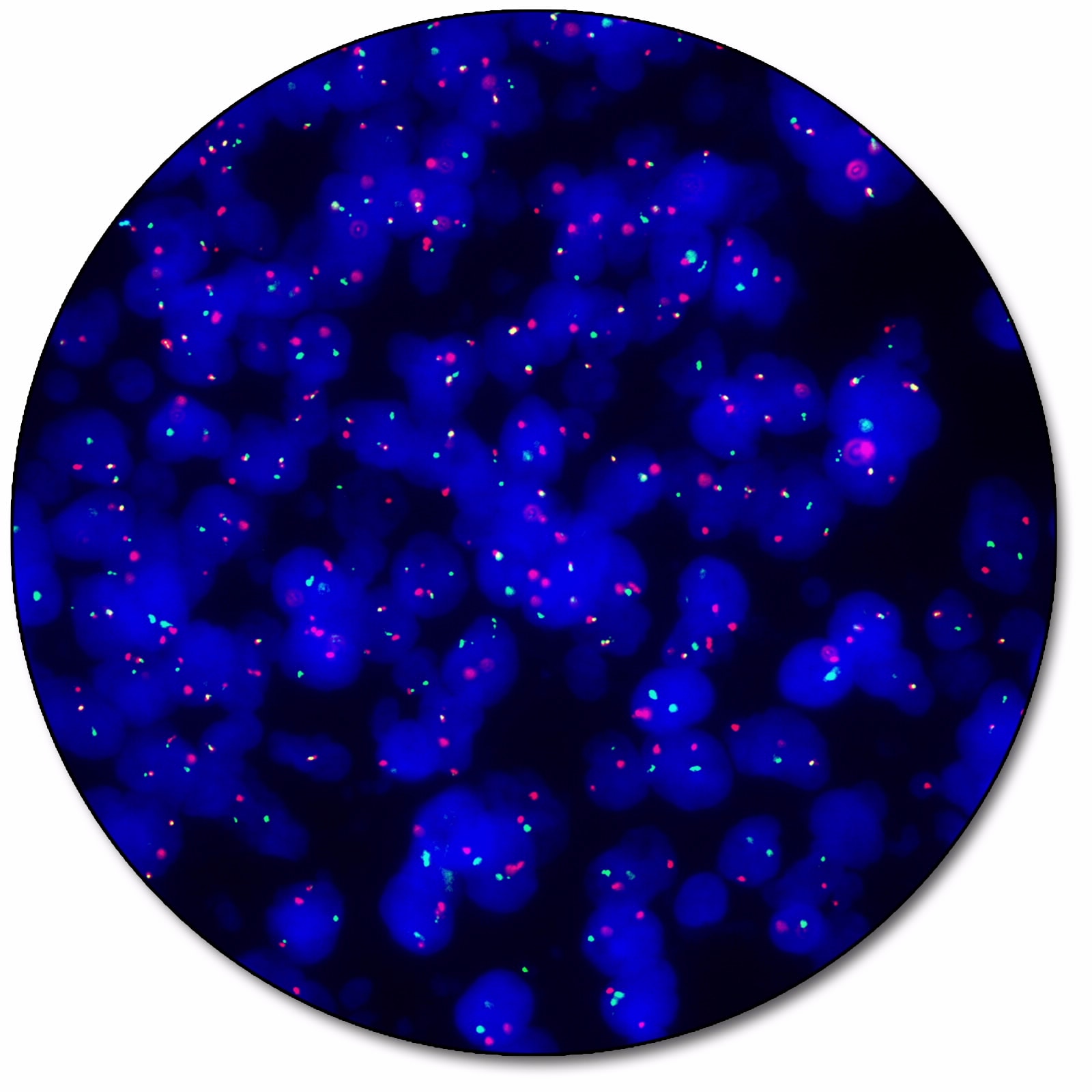 IGH/BCL2 IQFISH Dual Fusion Probe | Agilent