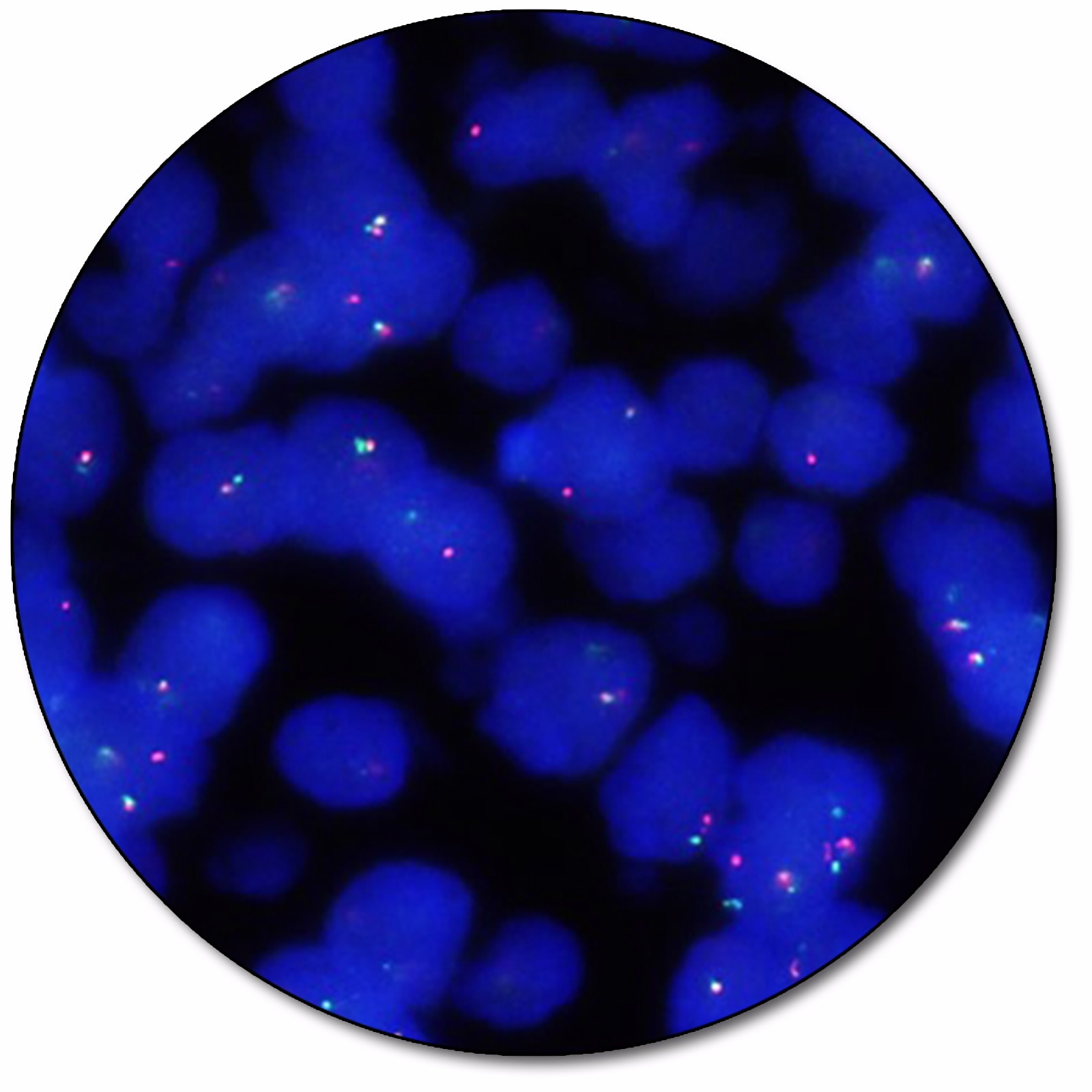 IGH IQFISH Break-Apart Probe | Agilent