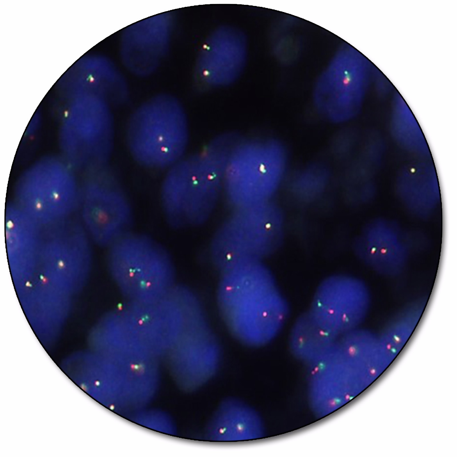 IGH IQFISH Break-Apart Probe | Agilent