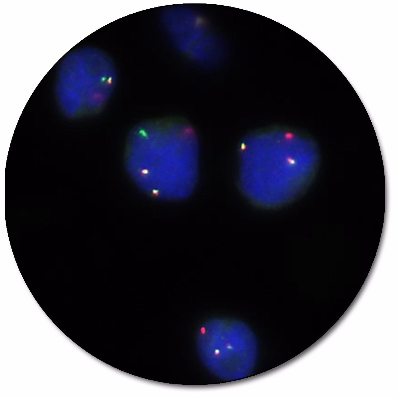 IGH/MYC IQFISH Dual Fusion Probe | Agilent