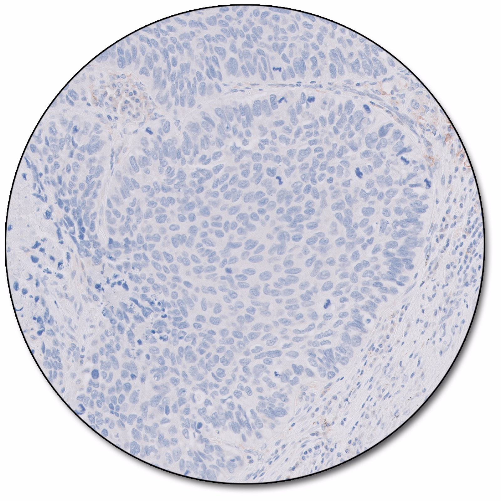 PD-L1 IHC 28-8 pharmDx for Autostainer Link 48 | Agilent