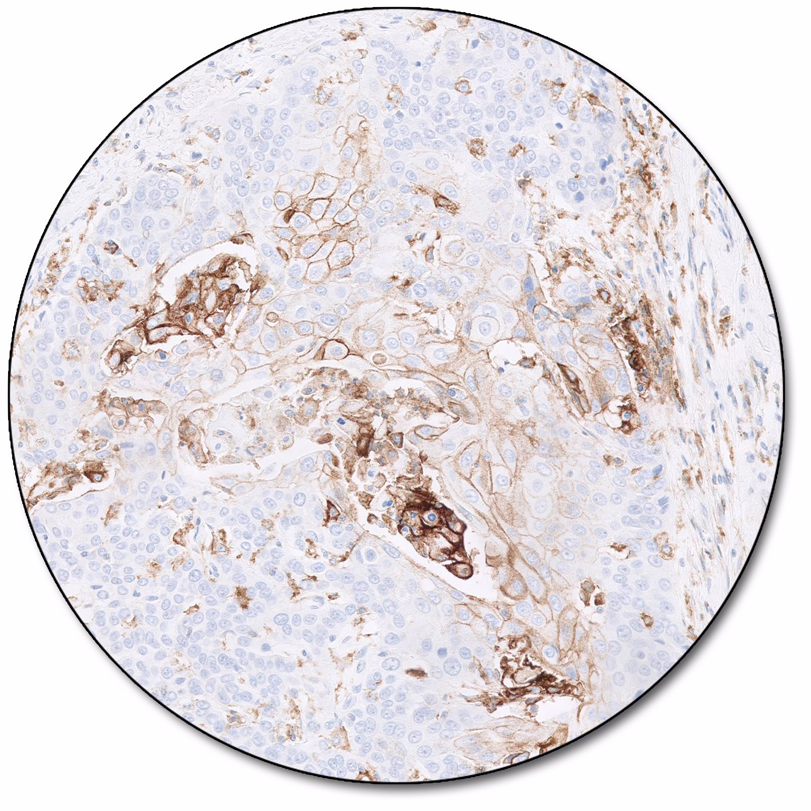 PD-L1 IHC 22C3 pharmDx for Autostainer Link 48 | Agilent