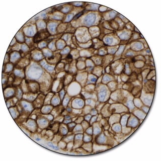 PD-L1 IHC 22C3 pharmDx for Autostainer Link 48 | Agilent